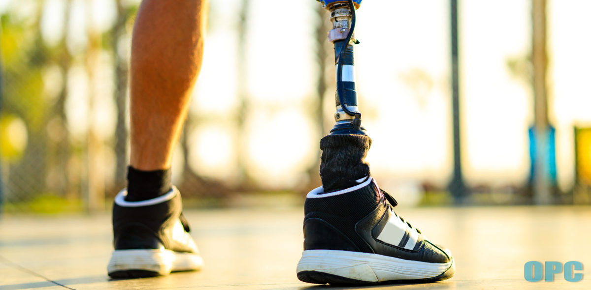 Six Interesting Things to Know About Custom Prosthesis | OP Centers