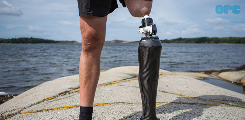 Should You Try a Bone Anchored Prosthesis? | OP Centers