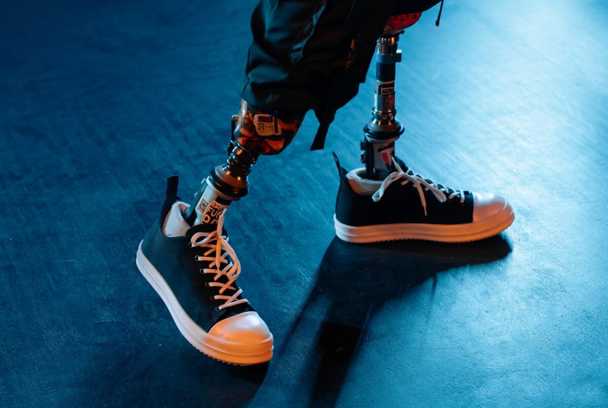 What materials are commonly used for making prosthetics? | OP Centers