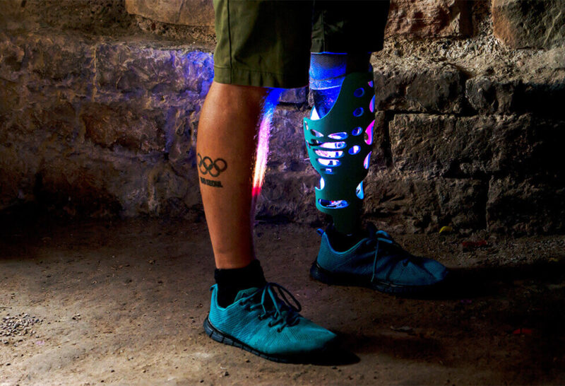 Prosthetics and Fashion: Merging Style with Functionality | OP Centers