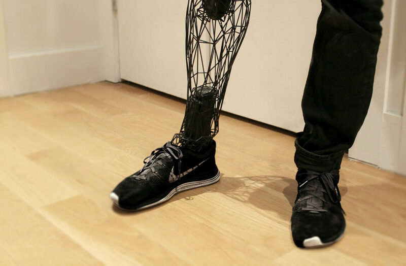 The Marvels of 3D Printing in Prosthetics | OP Centers
