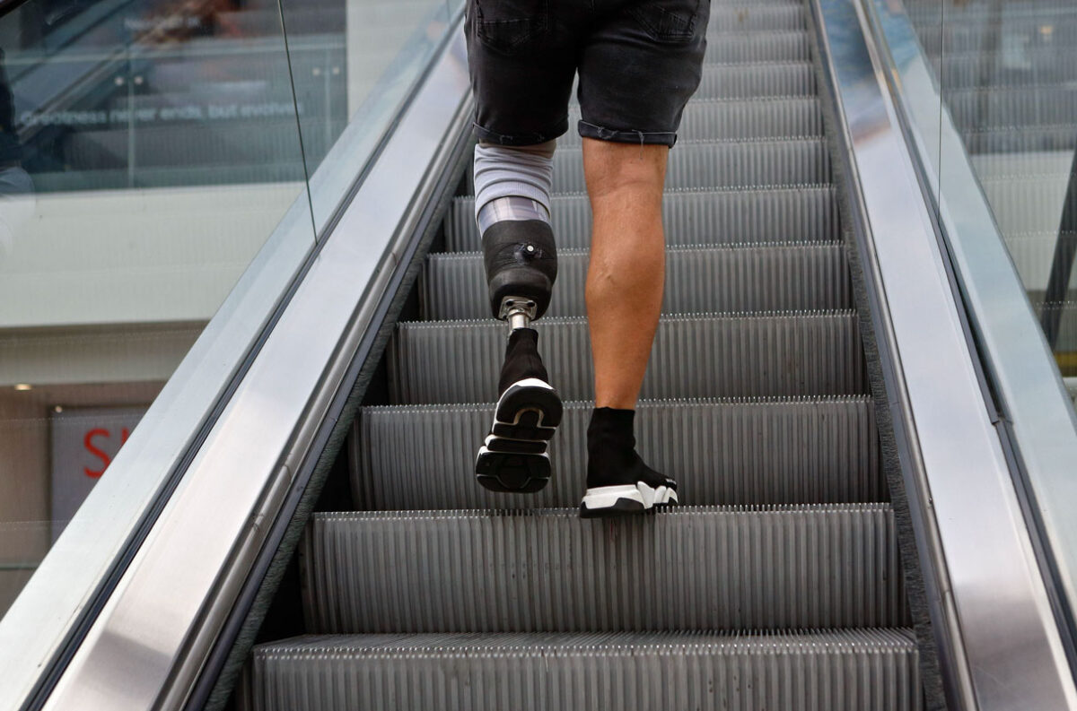 Factors to Consider When Choosing the Right Prosthetic | OP Centers