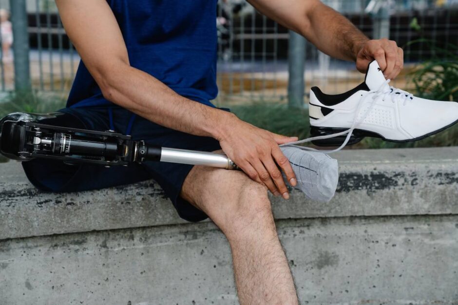 The 4 Types of Prosthetics | OP Centers